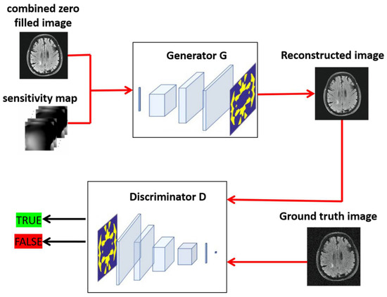 GAN-TL: Generative Adversarial Networks with Transfer Learning for MRI ...