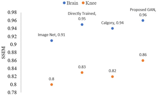 GAN-TL: Generative Adversarial Networks with Transfer Learning for MRI ...