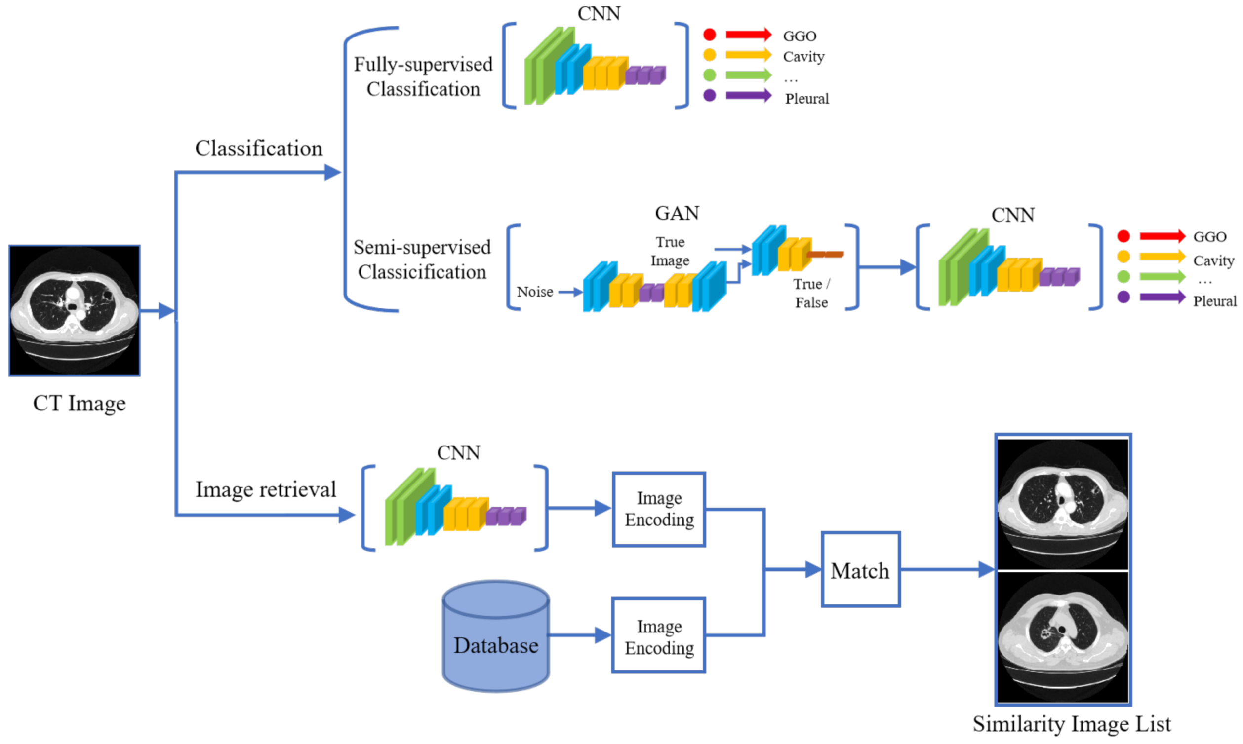 Applied Sciences | Free Full-Text | The Progress on Lung Computed Tomography Imaging Signs: A Review