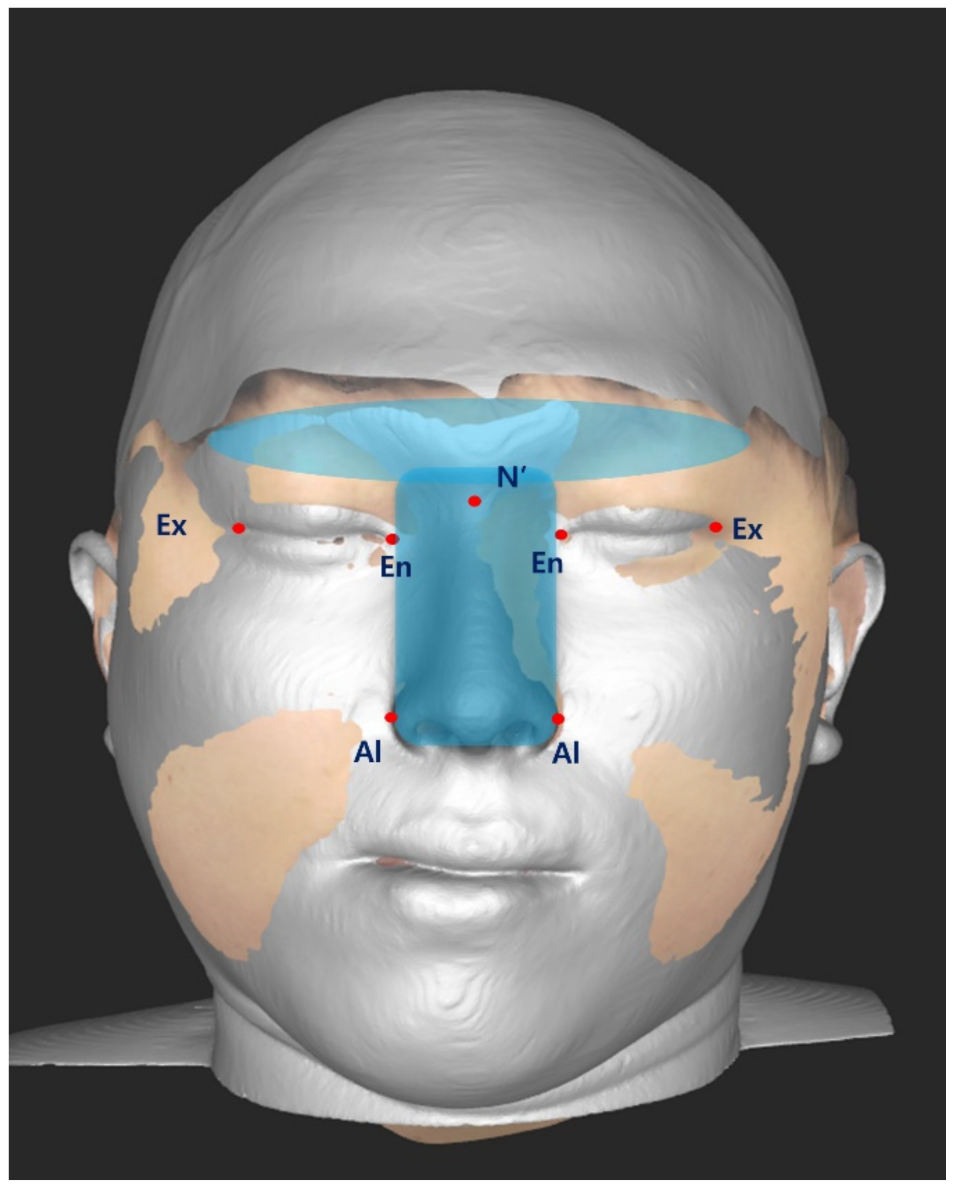 Applied Sciences | Free Full-Text | Three-Dimensional Change of Lip after Two-Jaw Surgery in ...
