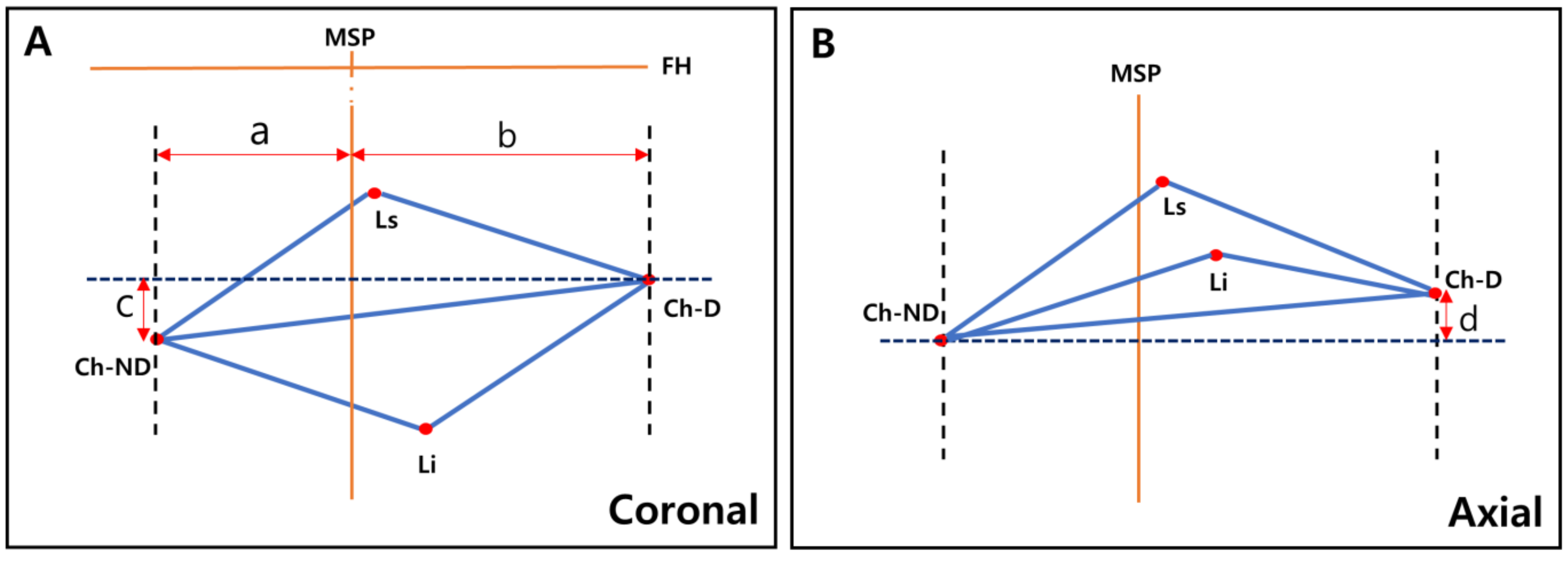 Applied Sciences | Free Full-Text | Three-Dimensional Change of Lip after Two-Jaw Surgery in ...