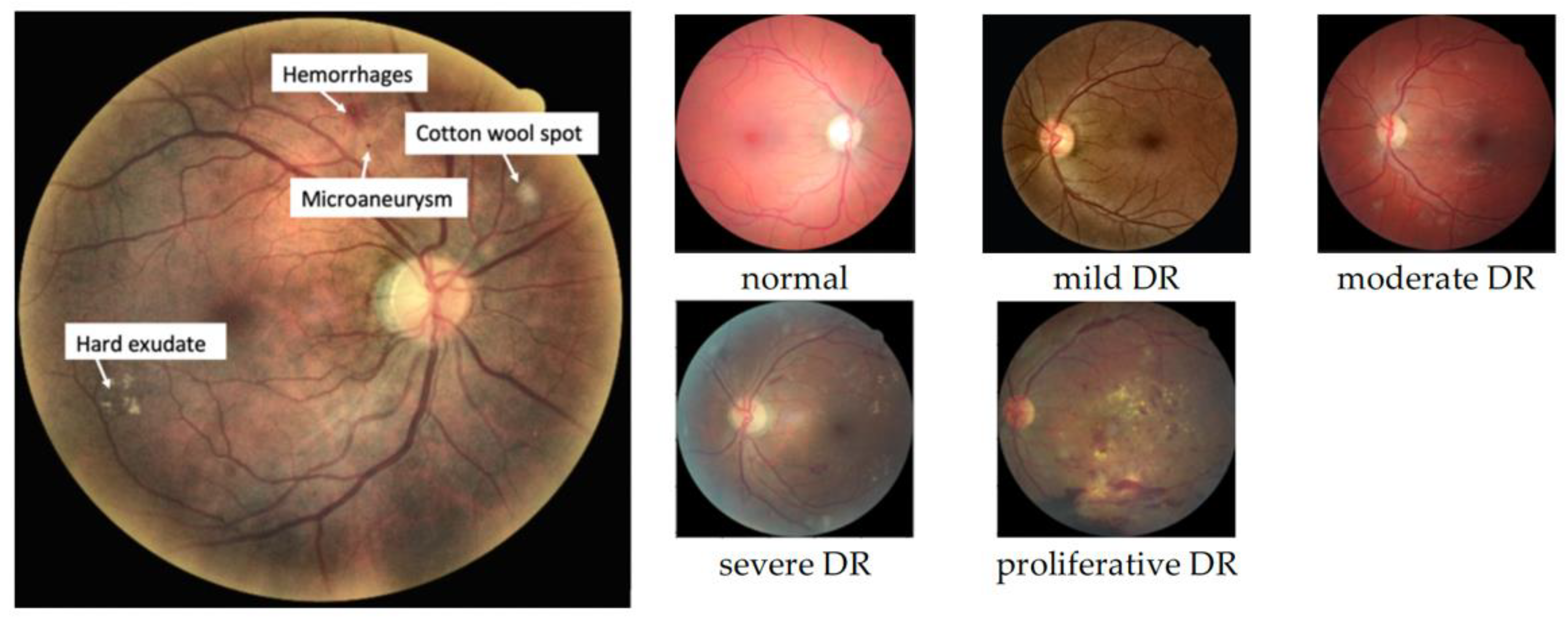 Towards Explainable Deep Neural Networks for the Automatic Detection of ...