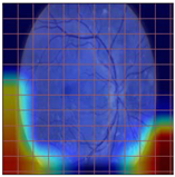 Towards Explainable Deep Neural Networks for the Automatic Detection of Diabetic Retinopathy