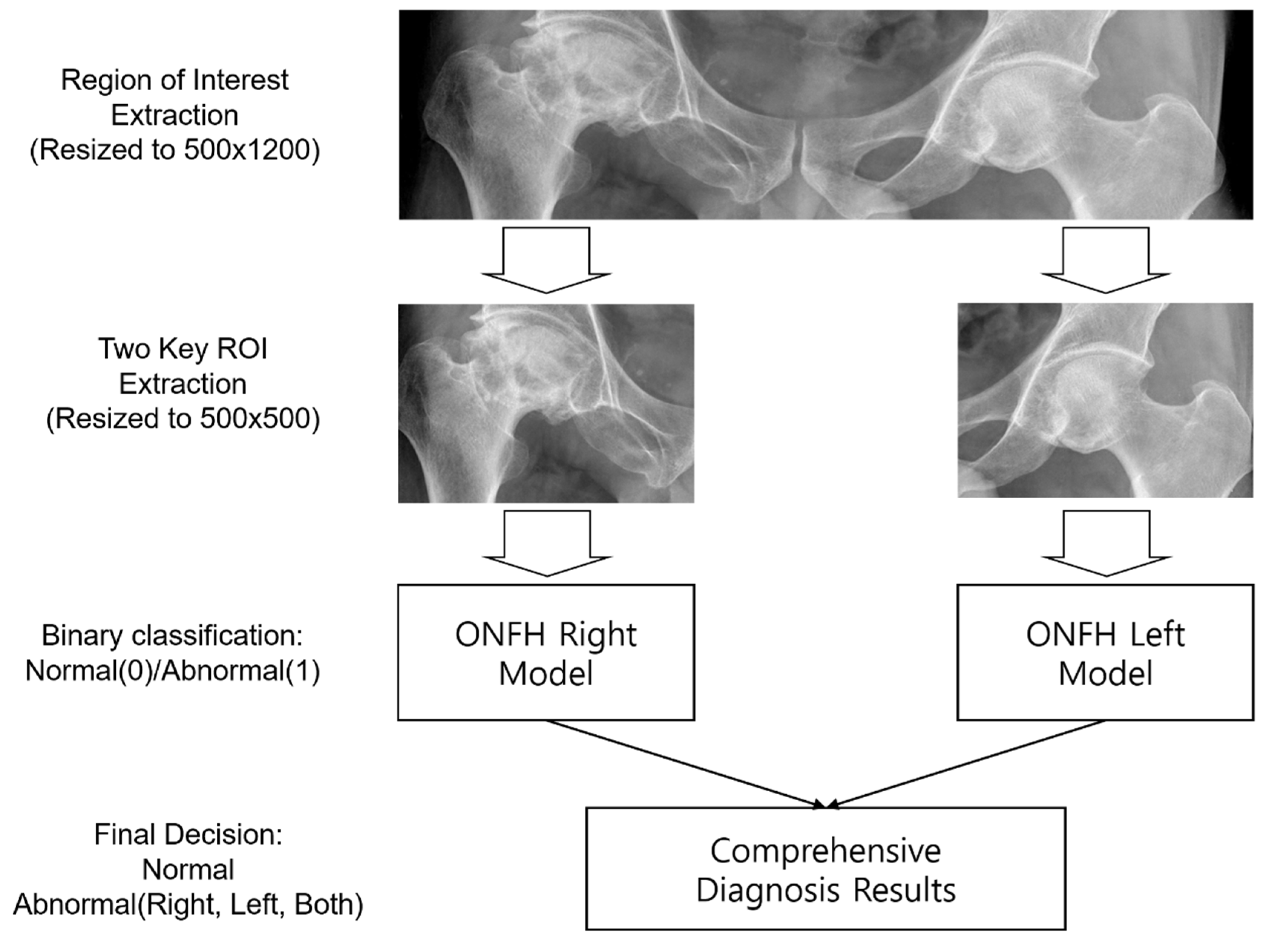 Applied Sciences | Free Full-Text | Convolutional Neural Network ...