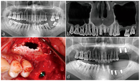 Applied Sciences | Free Full-Text | Preliminary Approach for Open ...