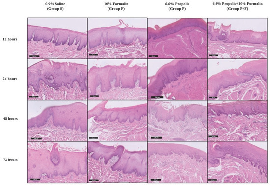 Propolis as a Potential Novel Histological Tissue Fixative: A ...