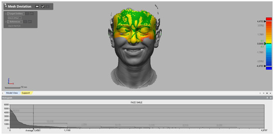 The Virtual Patient in Daily Orthodontics: Matching Intraoral and ...