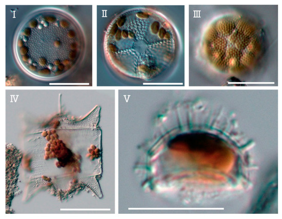Distribution of Diatom Resting Stages in Sediment near Artificial Reefs ...