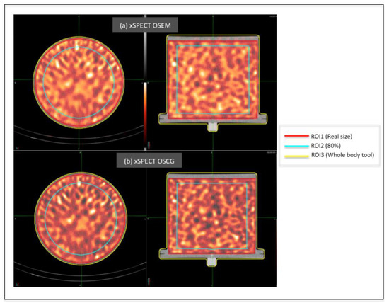 Optimization of 99mTc-MAA SPECT/CT Imaging for 90Y Radioembolization ...