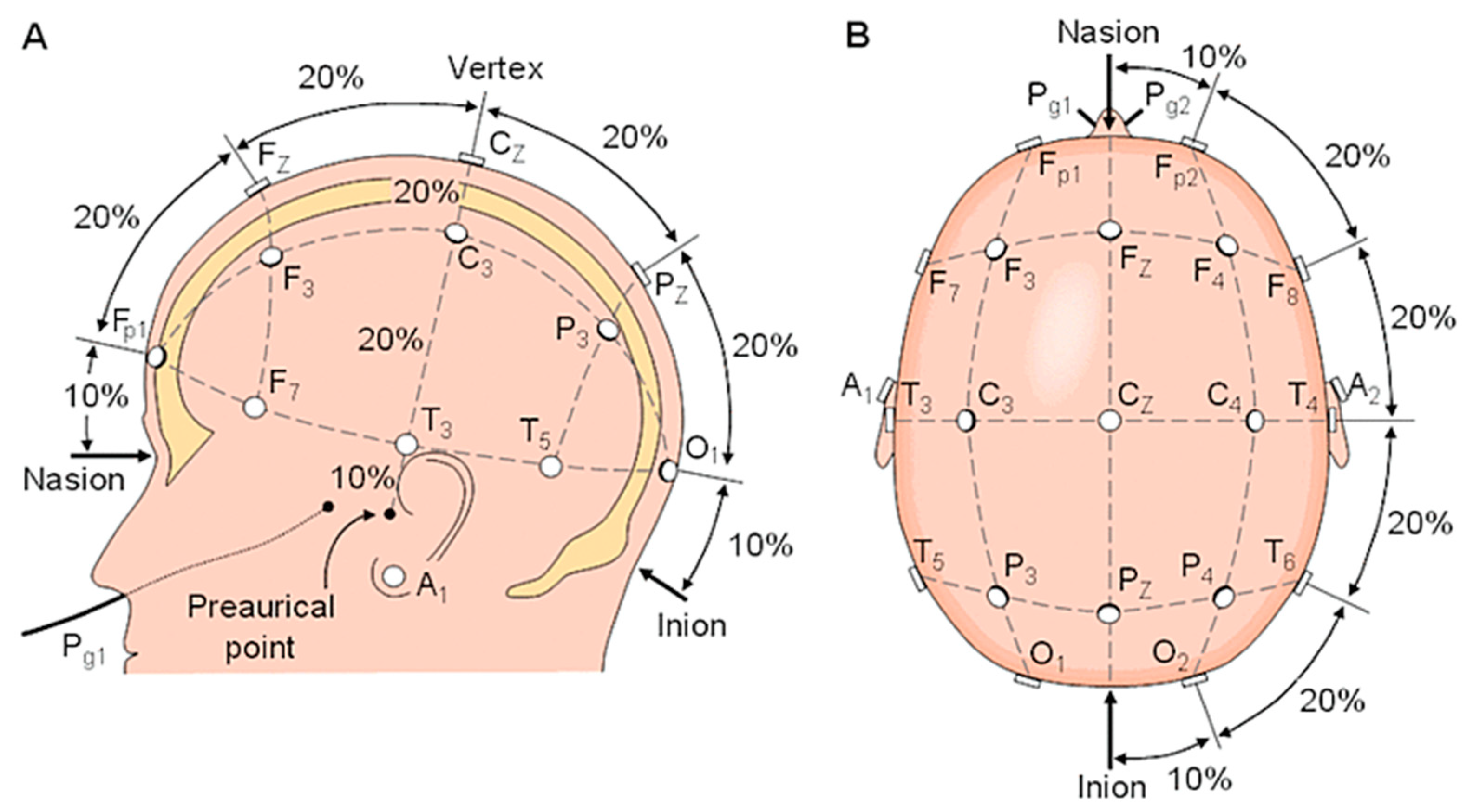 A Novel Approach for Emotion Recognition Based on EEG Signal Using Deep Learning