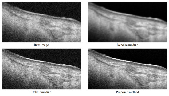 One-Step Enhancer: Deblurring and Denoising of OCT Images
