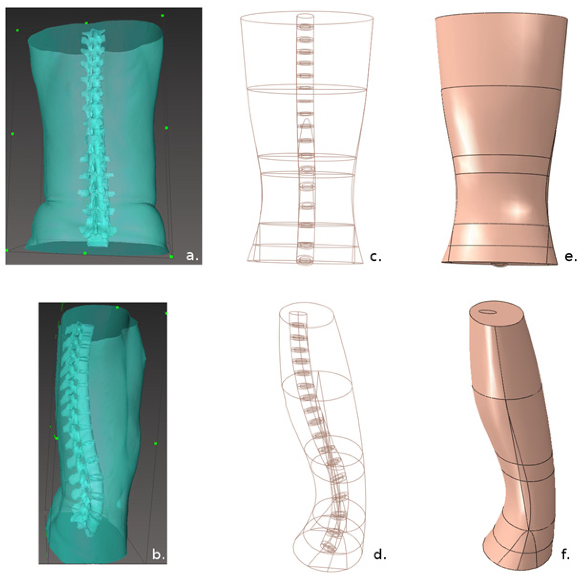 An In-Silico Study on the Therapeutic Effect of Low Back Belts ...
