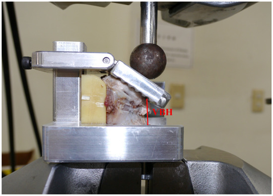 Biomechanical Evaluation of a Novel Expandable Vertebral Augmentation ...