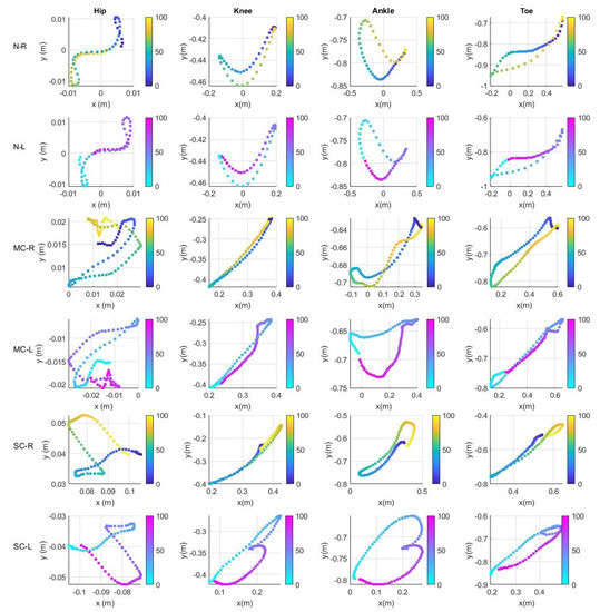 Crouch Gait Analysis and Visualization Based on Gait Forward and ...