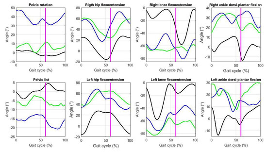 Crouch Gait Analysis and Visualization Based on Gait Forward and ...
