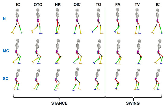 Crouch Gait Analysis and Visualization Based on Gait Forward and ...