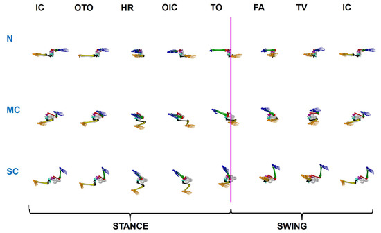 Crouch Gait Analysis and Visualization Based on Gait Forward and Inverse Kinematics