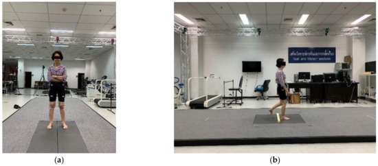 Obstacle Crossing in Older Adults with Total Knee Arthroplasty at the ...