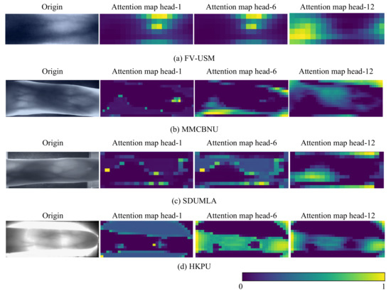 ViT-Cap: A Novel Vision Transformer-Based Capsule Network Model for ...