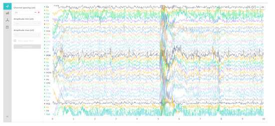 BCI Wheelchair Control Using Expert System Classifying EEG Signals Based on Power Spectrum ...