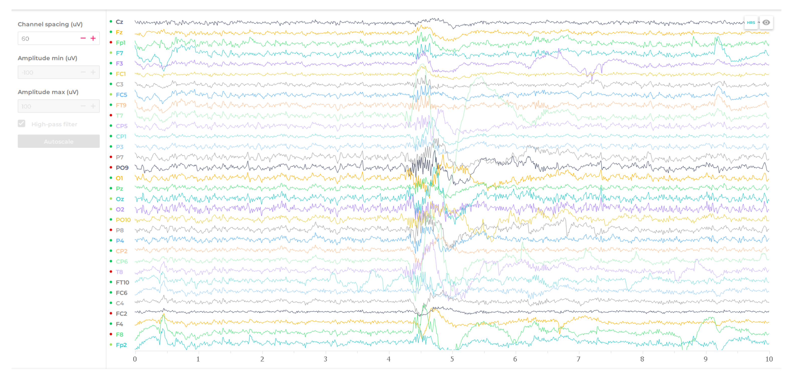 BCI Wheelchair Control Using Expert System Classifying EEG Signals Based on Power Spectrum ...