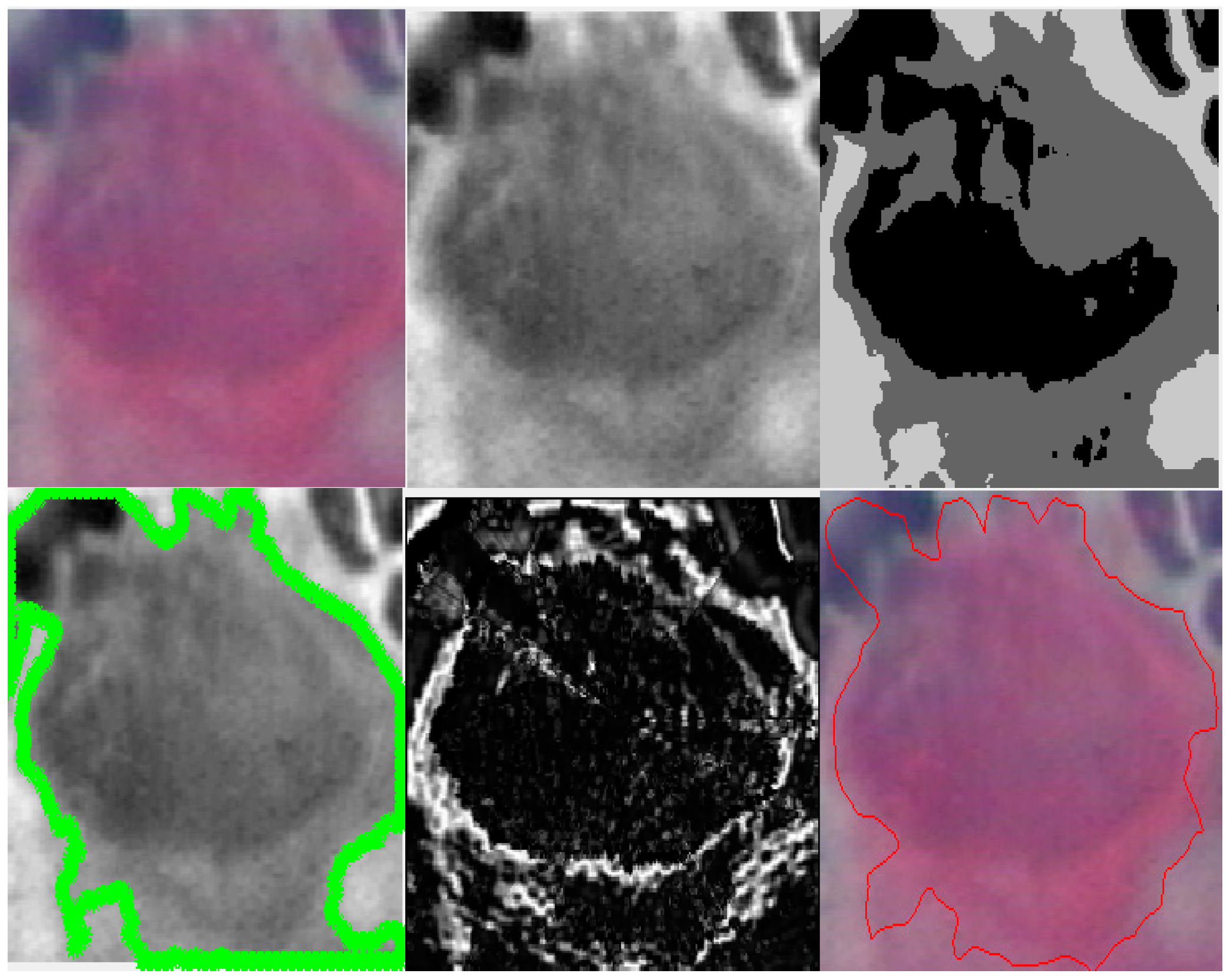 A Hybrid Linear Iterative Clustering and Bayes Classification-Based GrabCut Segmentation Scheme ...