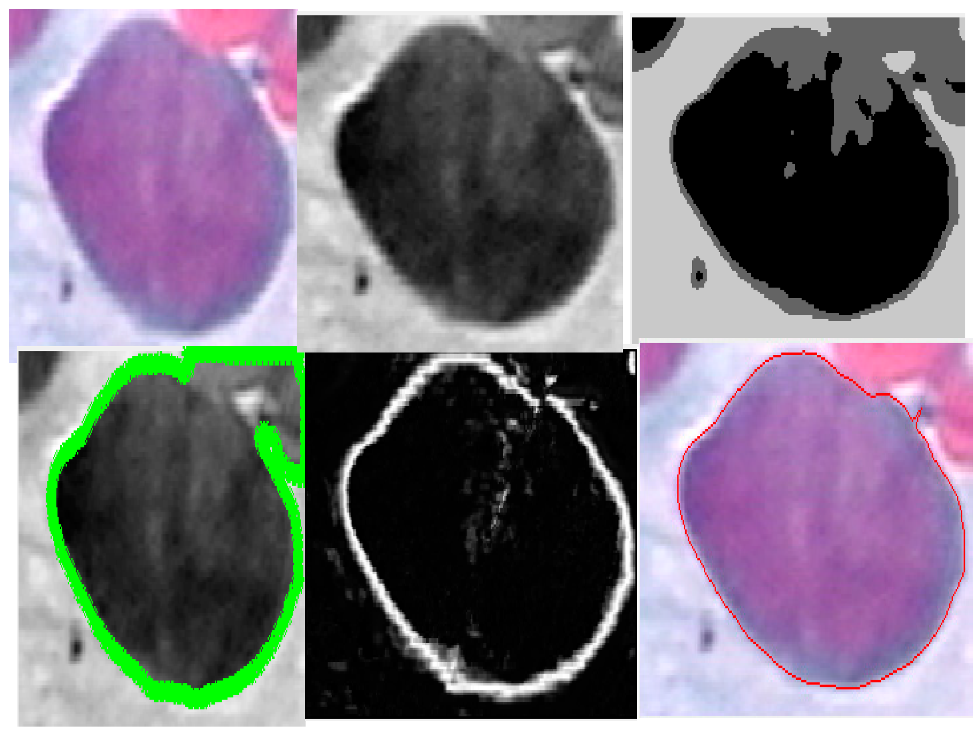 A Hybrid Linear Iterative Clustering and Bayes Classification-Based GrabCut Segmentation Scheme ...