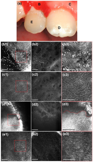 Applied Sciences | Free Full-Text | Dental Microstructural Imaging ...