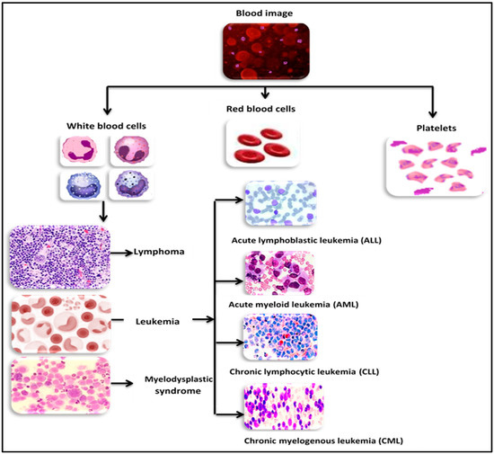 An Efficient Strategy for Blood Diseases Detection Based on Grey Wolf Optimization as Feature ...