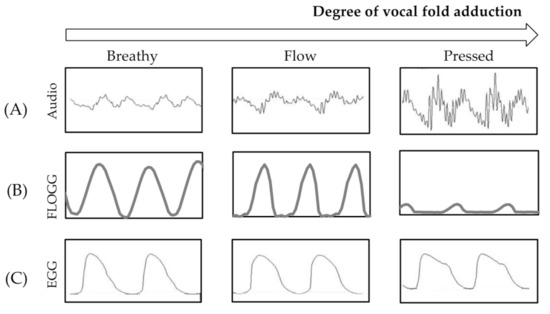 Real-Time Visual Feedback in Singing Pedagogy: Current Trends and ...