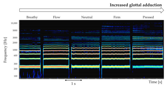 Real-Time Visual Feedback in Singing Pedagogy: Current Trends and ...