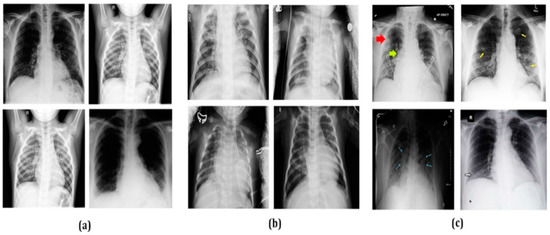 Evaluation and Optimization of Biomedical Image-Based Deep Convolutional Neural Network Model ...