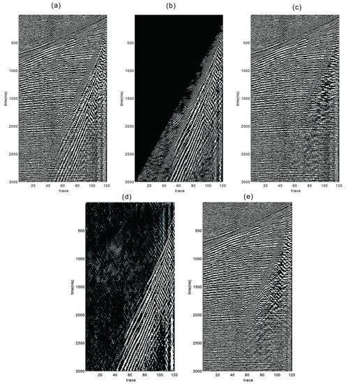 Seismic Coherent Noise Removal of Source Array in the NSST Domain
