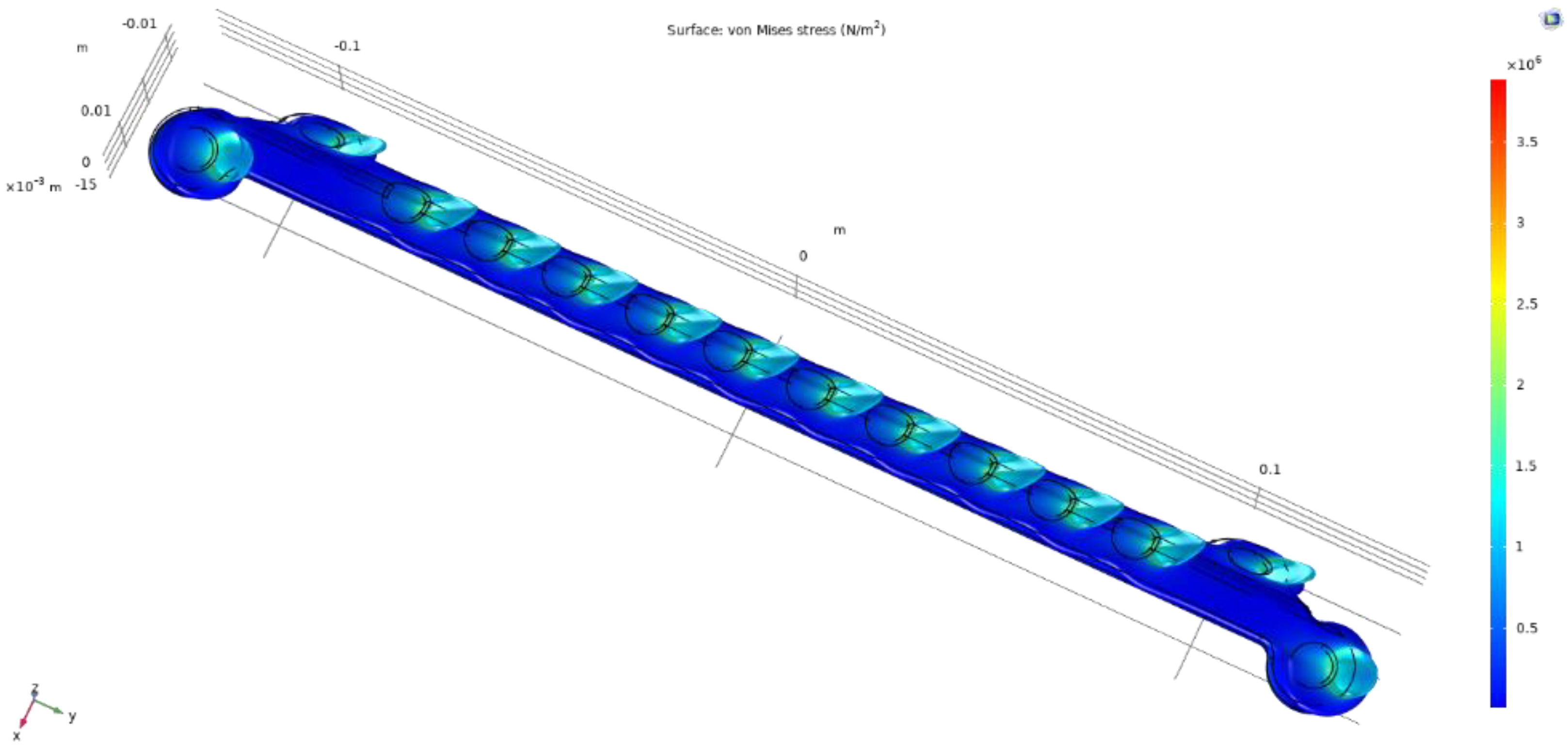 Development and Finite Element Analysis of a Novel Bent Bone Plate