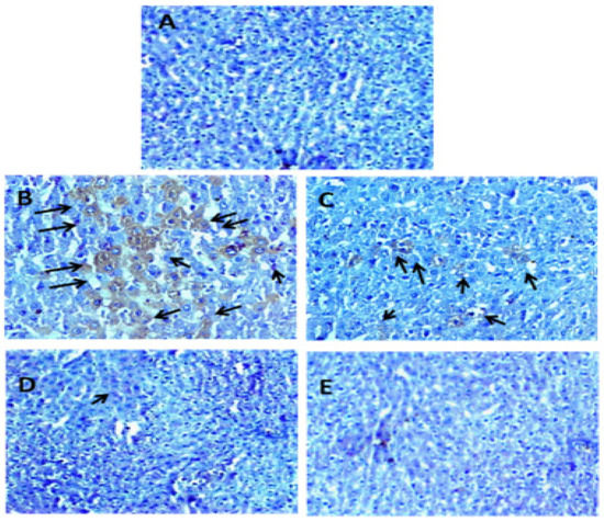 Carum carvi Modulates Acetaminophen-Induced Hepatotoxicity: Effects on ...