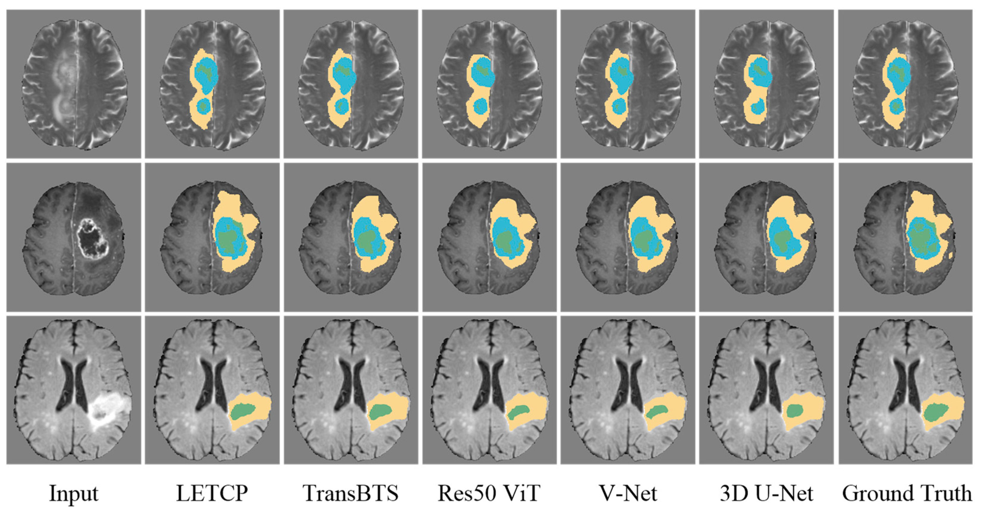 LETCP: A Label-Efficient Transformer-Based Contrastive Pre-Training Method for Brain Tumor ...
