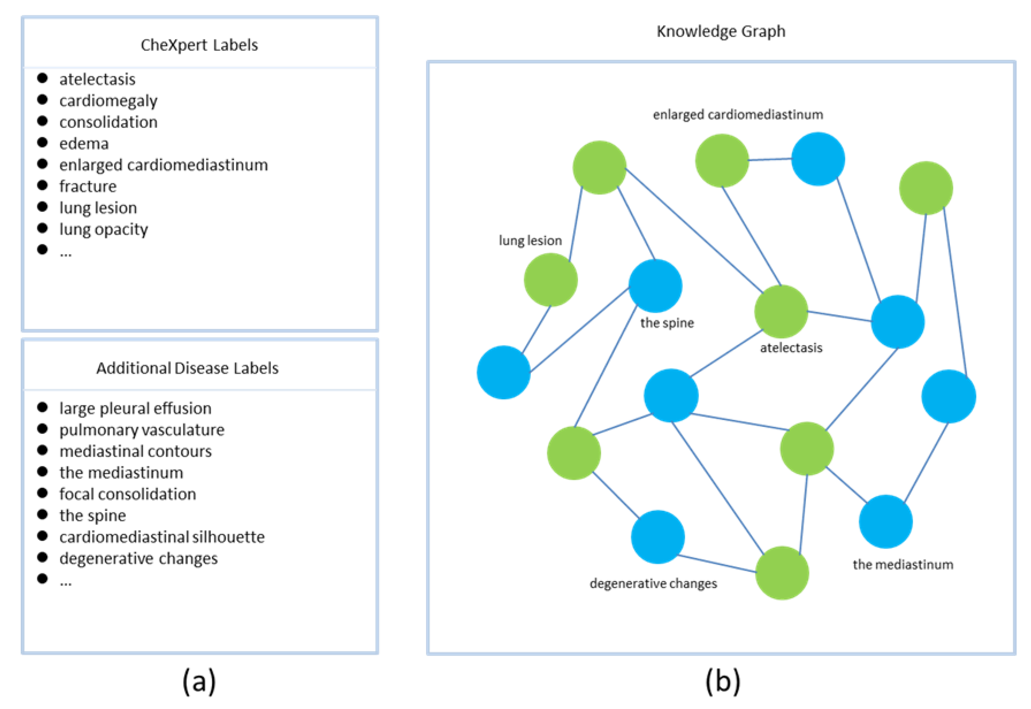 Improving Medical X-ray Report Generation by Using Knowledge Graph