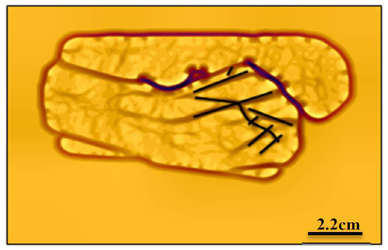 Near Infrared Illumination Optimization for Vein Detection: Hardware ...