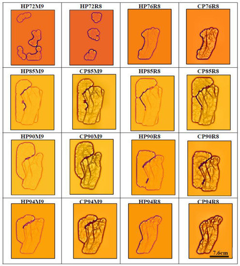 Near Infrared Illumination Optimization for Vein Detection: Hardware ...