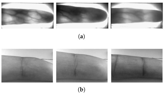 Finger Vein and Inner Knuckle Print Recognition Based on Multilevel Feature Fusion Network