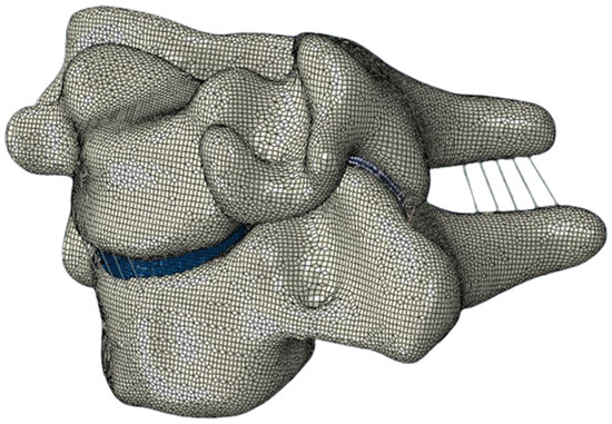 Development of a Finite Element Model of the Cervical Spine and ...