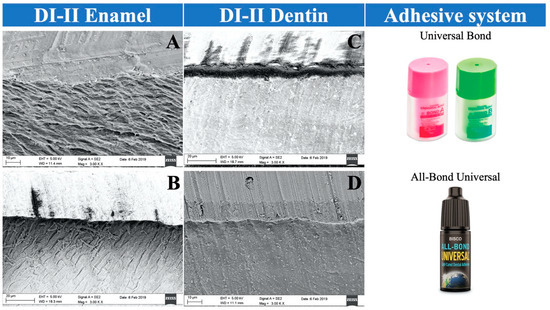 SEM Evaluation of the Hybrid Layer of Two Universal Adhesives on Sound ...