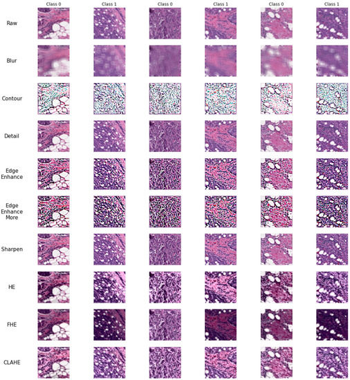 Impact of Image Preprocessing Methods and Deep Learning Models for Classifying Histopathological ...