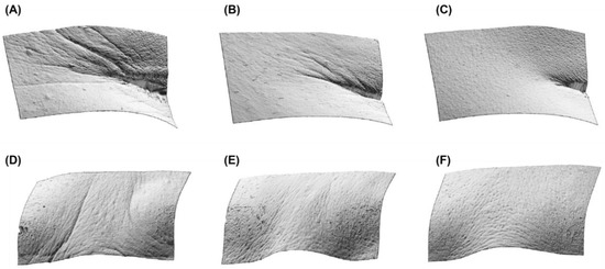 Novel Genetic Associations for Skin Aging Phenotypes and Validation of ...