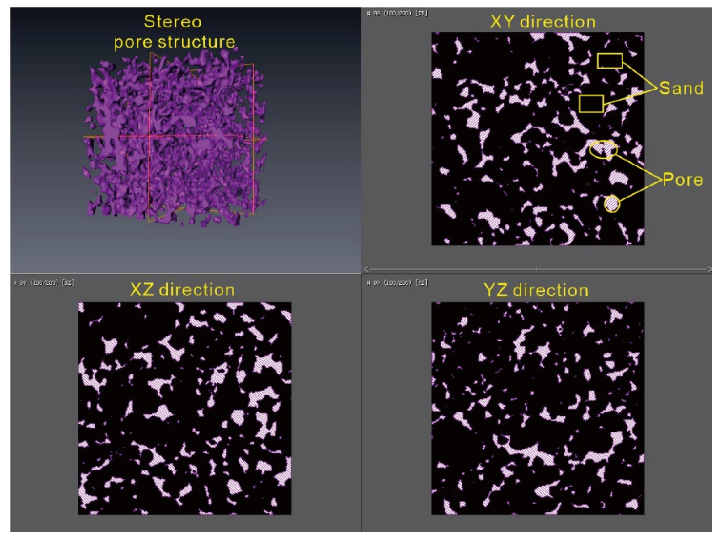Experimental Study on the Permeability of Microbial-Solidified ...