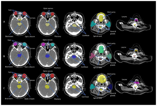 Clinical Evaluation of Deep Learning and Atlas-Based Auto-Contouring ...