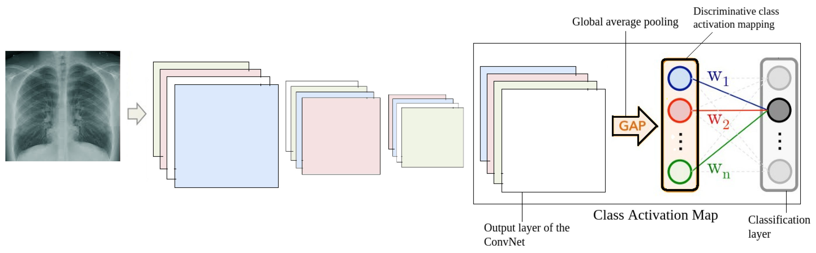 Explainable-AI in Automated Medical Report Generation Using Chest X-ray Images