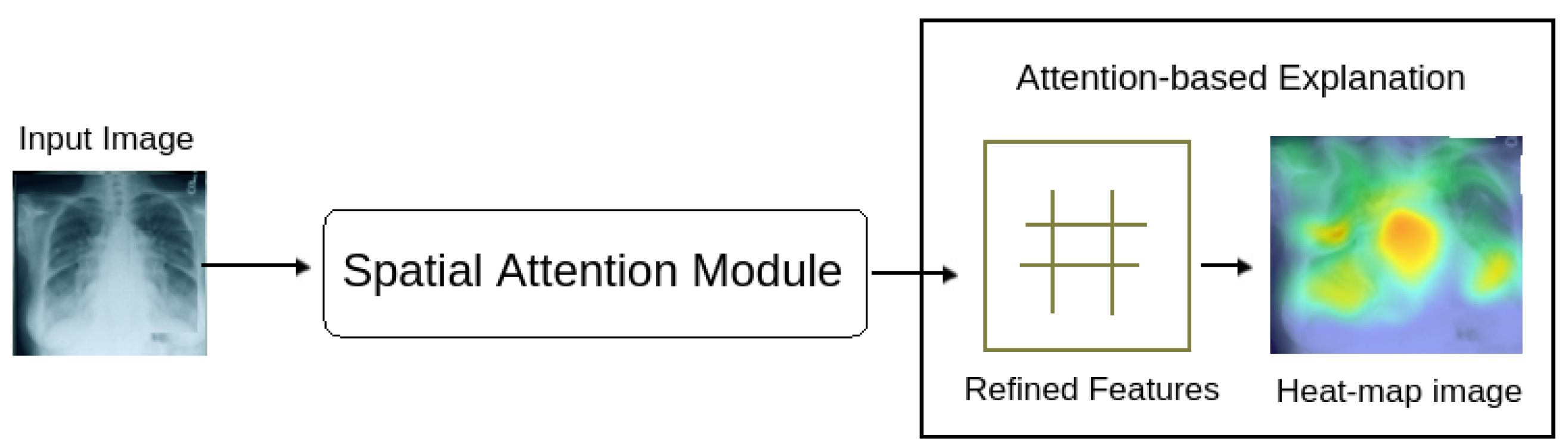 Explainable-AI in Automated Medical Report Generation Using Chest X-ray Images