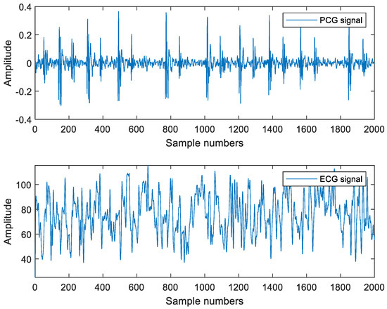 Research on the Classification of ECG and PCG Signals Based on BiLSTM ...