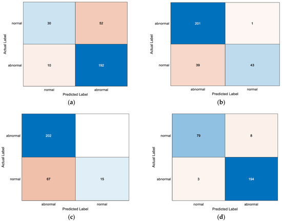 Research on the Classification of ECG and PCG Signals Based on BiLSTM ...